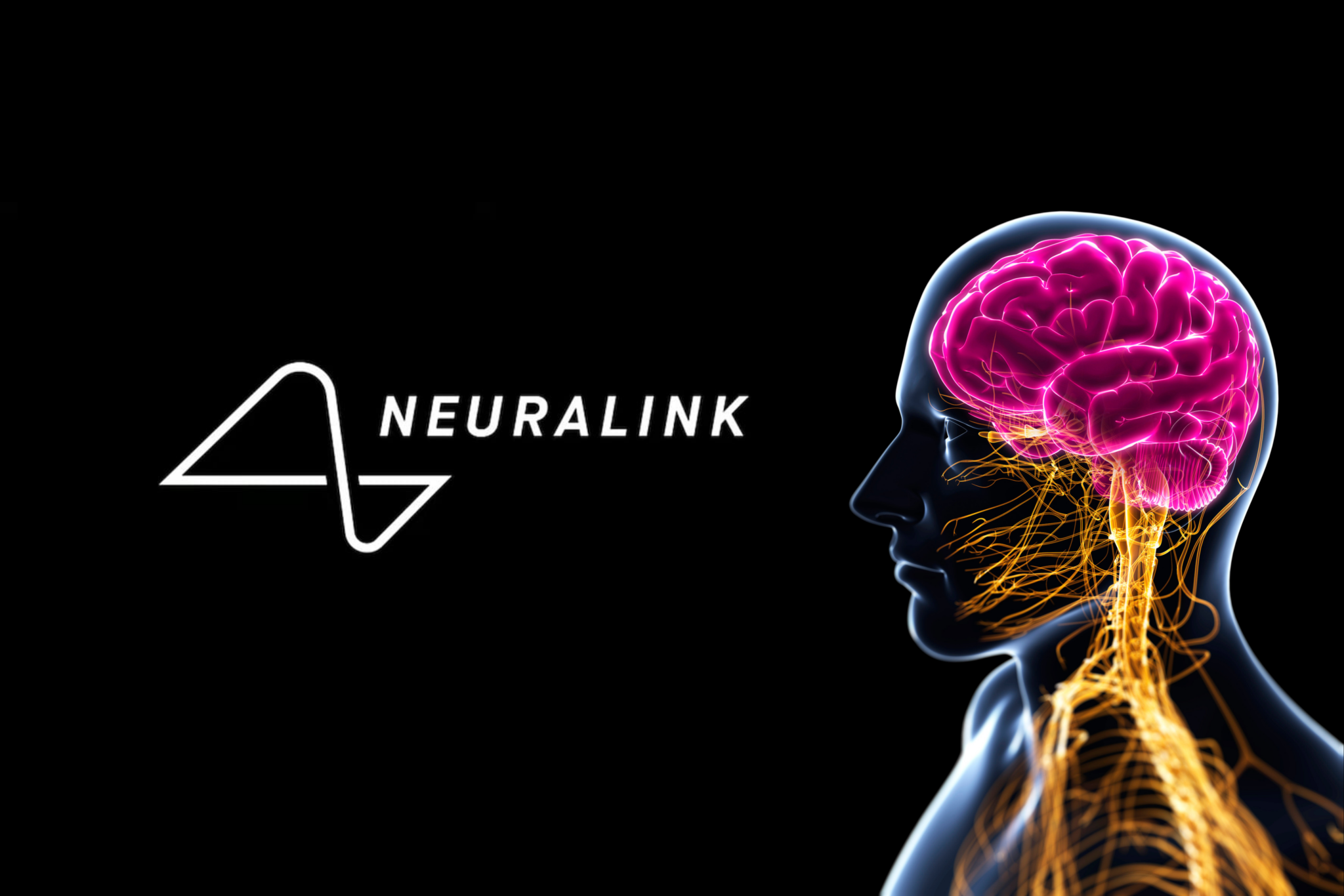 Neuralink de Elon Musk empieza a hacer pruebas con humanos - Marketing4all